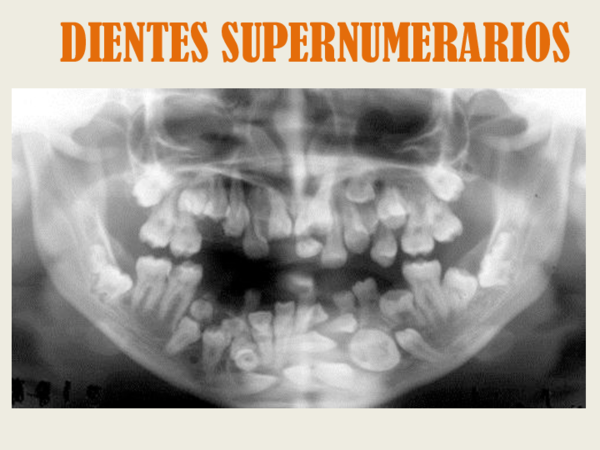 (PPT) supernumerarios