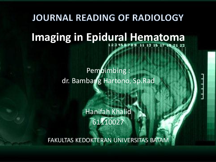 (PPT) EDH Radiology