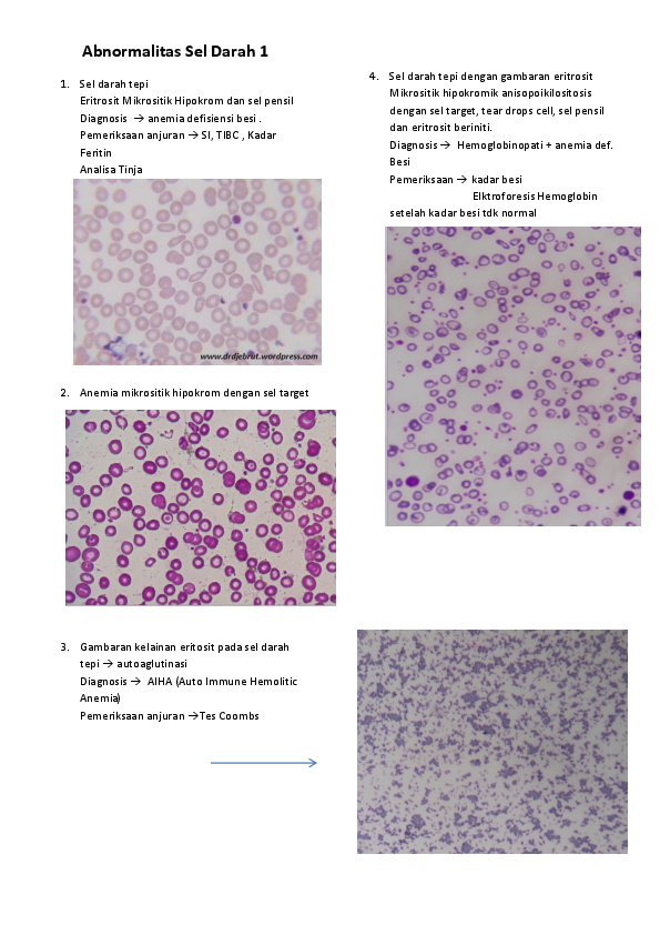 (DOC) Abnormalitas Sel Darah 1