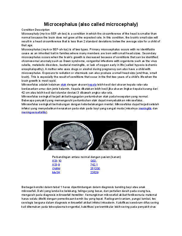 (DOC) Microcephalus (also called microcephaly