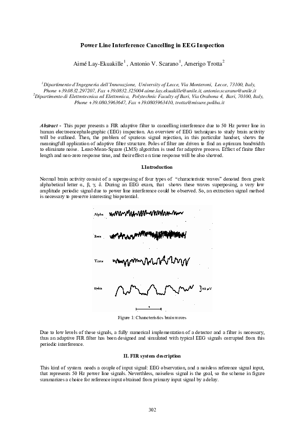 Power Line Interference Cancelling in EEG Inspection