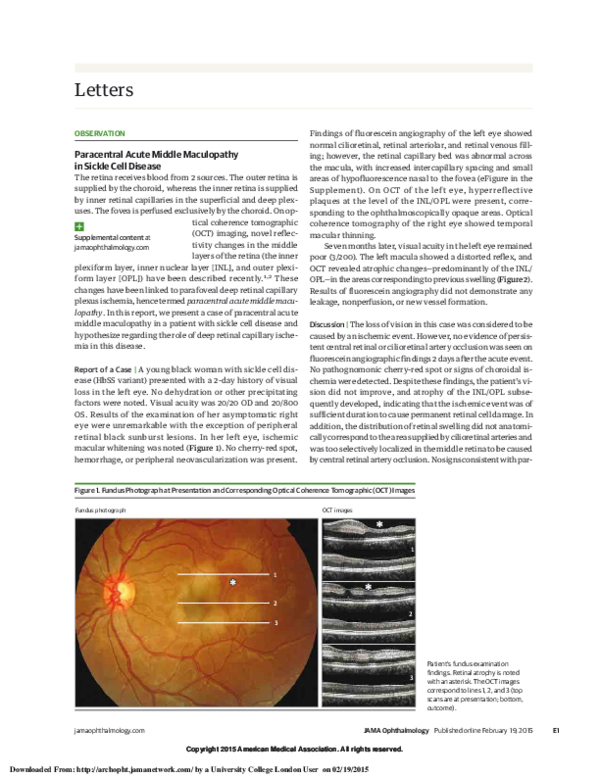 (PDF) Paracentral Acute Middle Maculopathy in Sickle Cell Disease