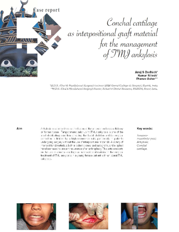conchal cartilage as interpositional graft material for the management ...