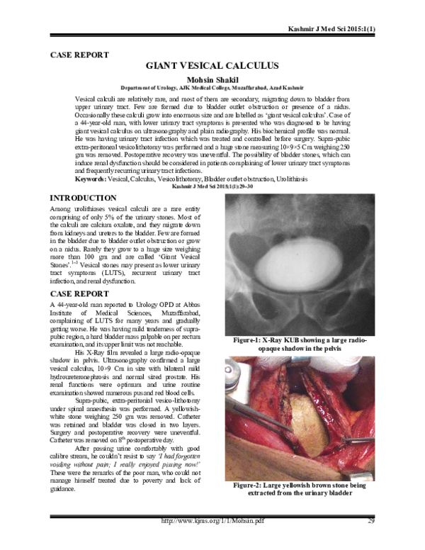 (PDF) Case Report: Giant Vesical Calculus