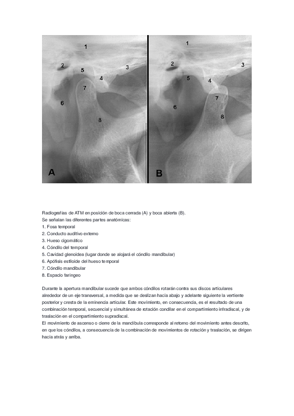 (DOC) Radiografias de ATM en posicion de boca cerrada