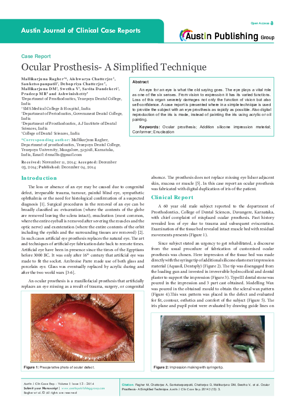 (PDF) ocular prosthesis
