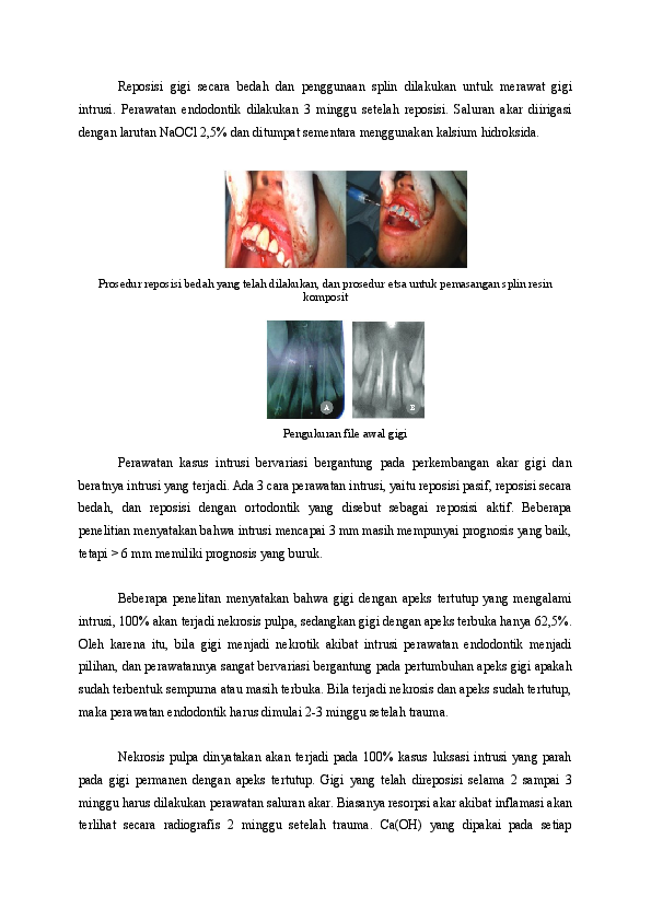 (DOC) KONSER - INTRUSI