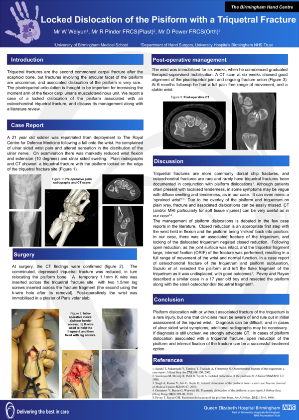 (PPT) Locked dislocation of the pisiform: A rare complication of a ...