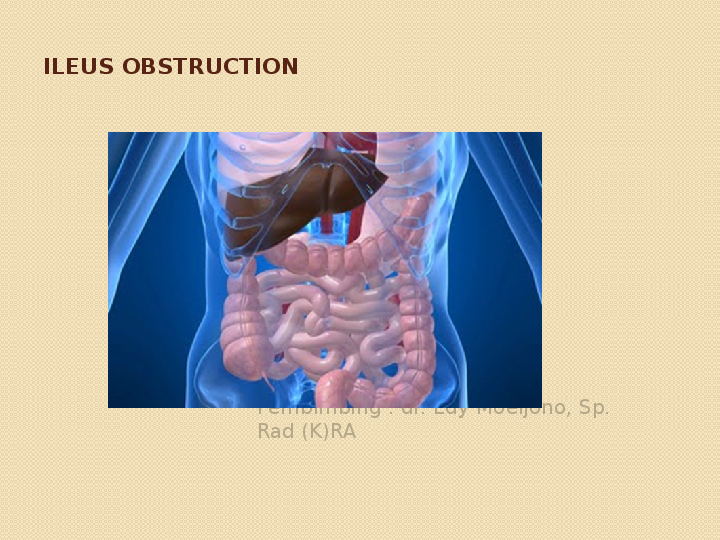 (PPT) ILEUS OBSTRUCTION 1