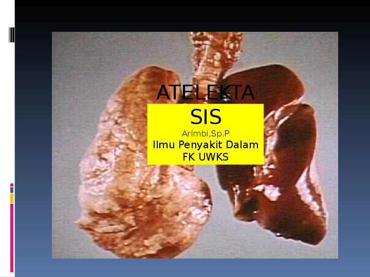 (PPT) atelektasis