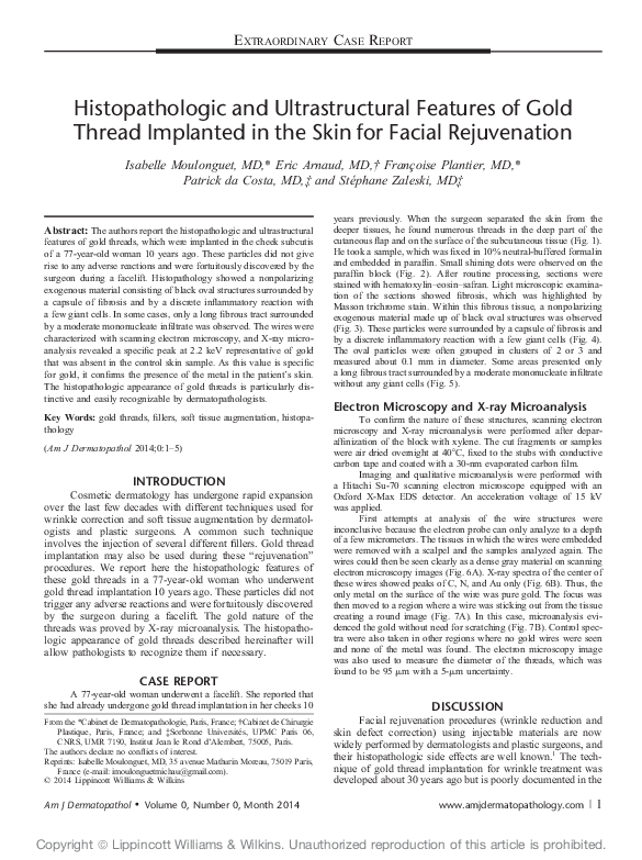 Histopathologic and Ultrastructural Features of Gold Thread Implanted ...