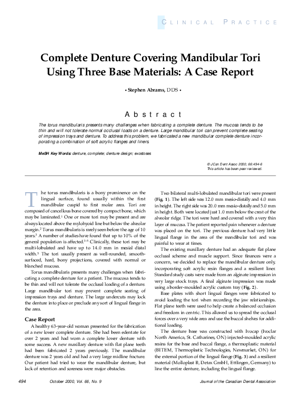(PDF) Complete denture covering mandibular tori using three base ...