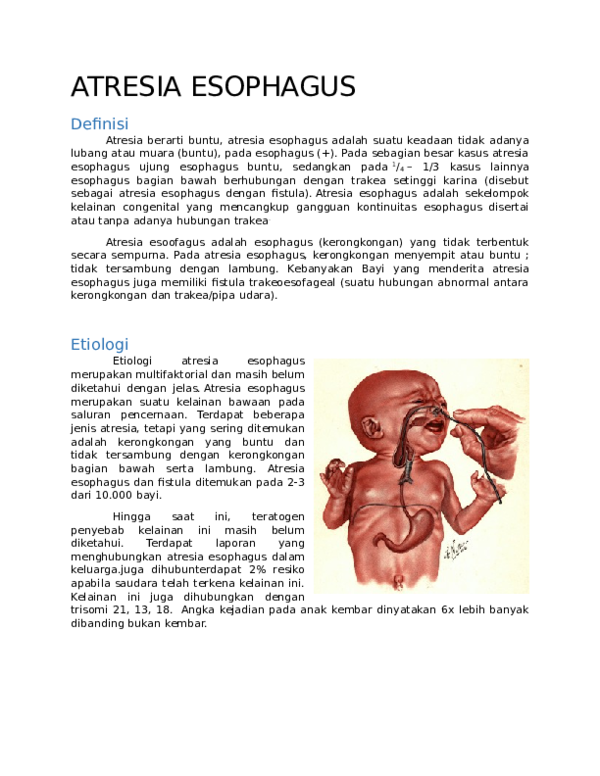 (DOC) atresia esofagus