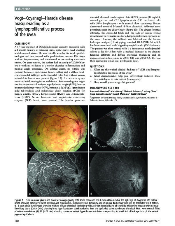(PDF) Vogt-Koyanagi-Harada disease masquerading as a lymphoproliferative process of the uvea.