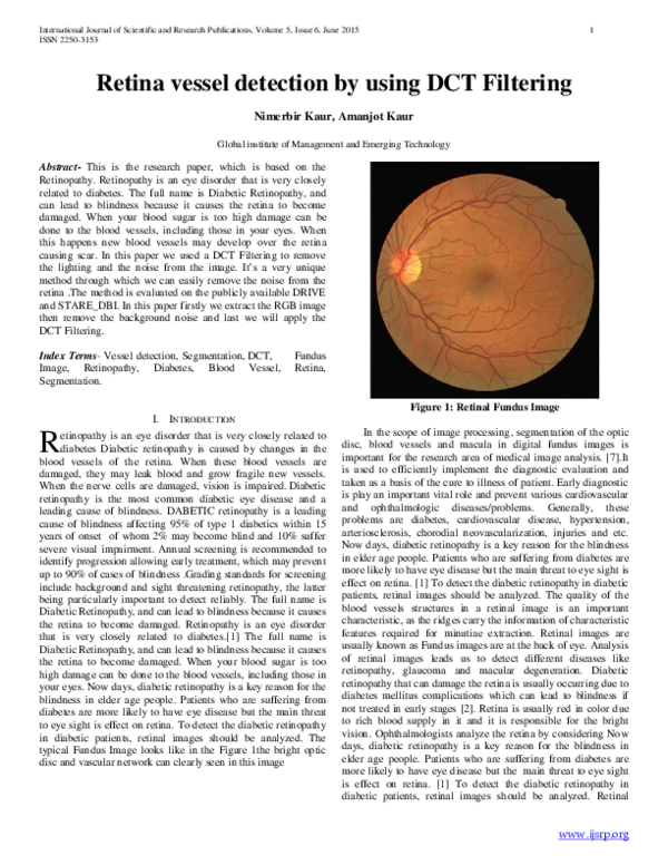 (PDF) Retina vessel detection by using DCT Filtering