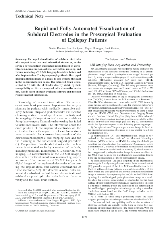 (PDF) Rapid and Fully Automated Visualization of Subdural Electrodes in the Presurgical ...