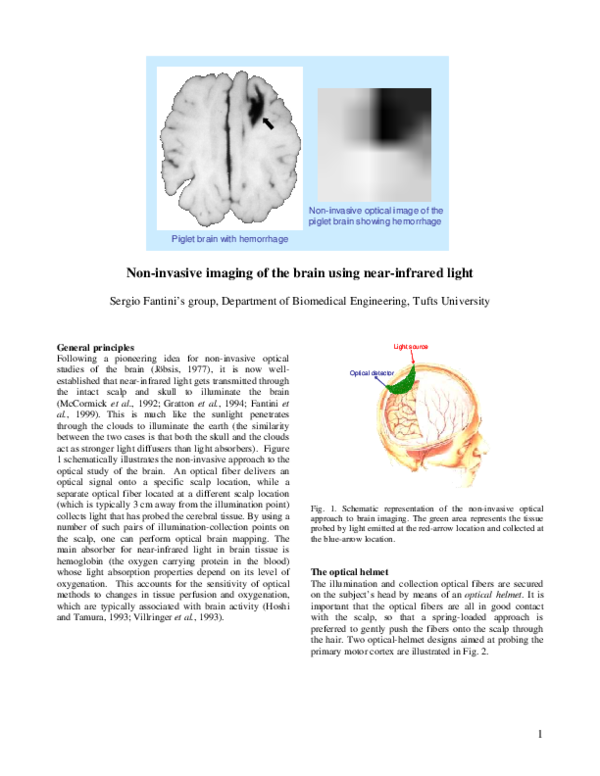 (PDF) Non-invasive imaging of the brain using near-infrared light