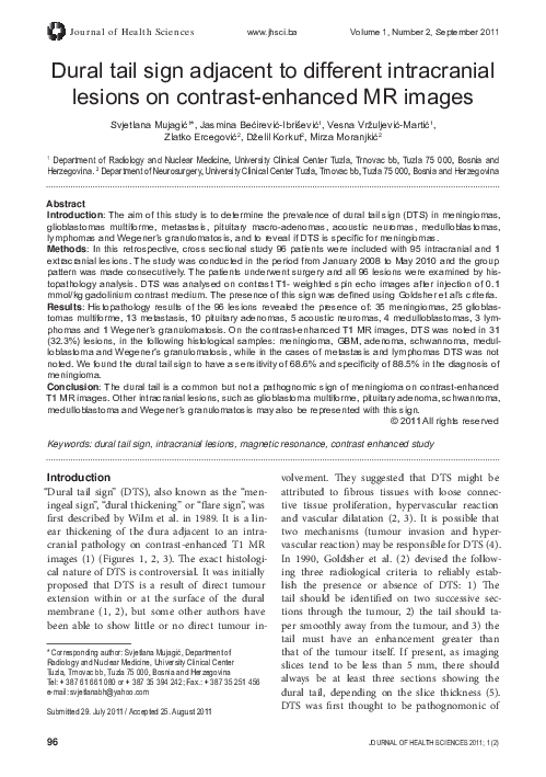 (PDF) Dural tail sign adjacent to different intracranial lesions on ...