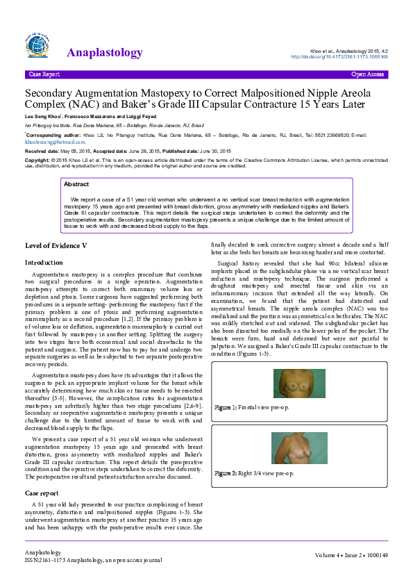 (PDF) Secondary Augmentation Mastopexy to Correct Malpositioned Nipple ...