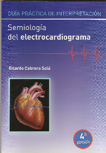 (PDF) GUI EKG VENTANILLA BEACH