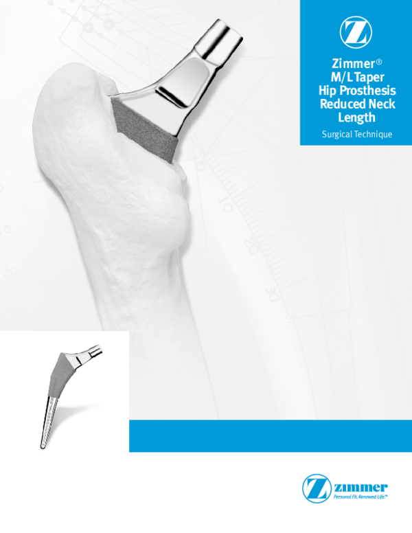 (PDF) Zimmer ® M/L Taper Hip Prosthesis Reduced Neck Length Surgical ...