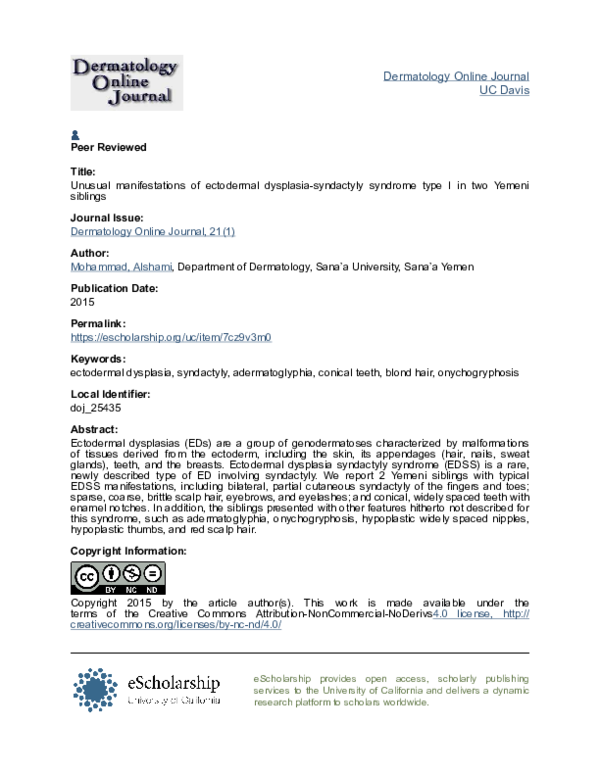 Unusual Manifestations Of Ectodermal Dysplasia Syndactyly Syndrome Type I In Two Yemeni Siblings