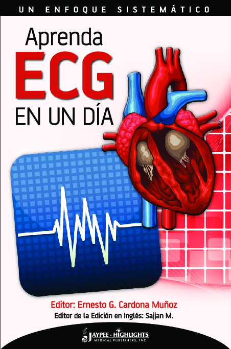 (PDF) Aprenda ECG en un dia