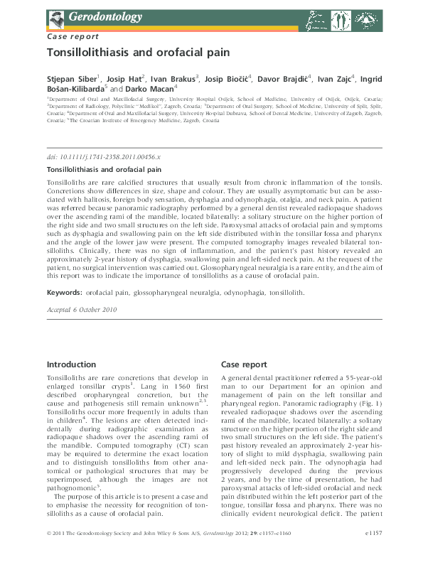 (PDF) Tonsillolithiasis and orofacial pain