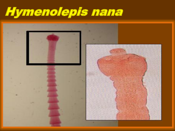 (PDF) Hymenolepis nana