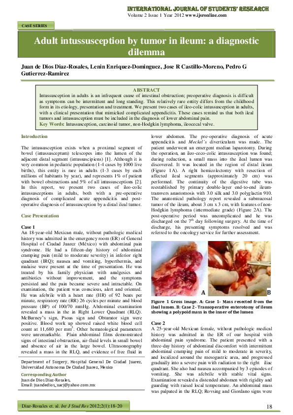 (PDF) Adult intussusception by tumor in ileum: a diagnostic dilemma