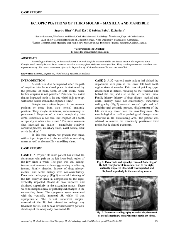 (PDF) ECTOPIC POSITIONS OF THIRD MOLAR – MAXILLA AND MANDIBLE