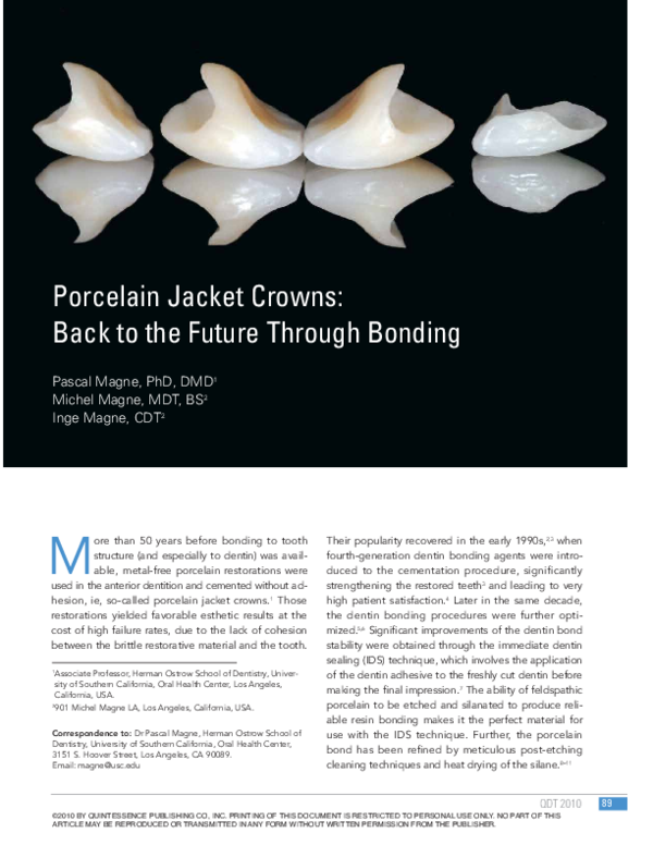 (PDF) Porcelain Jacket Crowns: Back to the Future Through Bonding