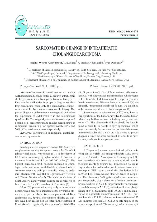 Sarcomatoid change in intrahepatic cholangiocarcinoma