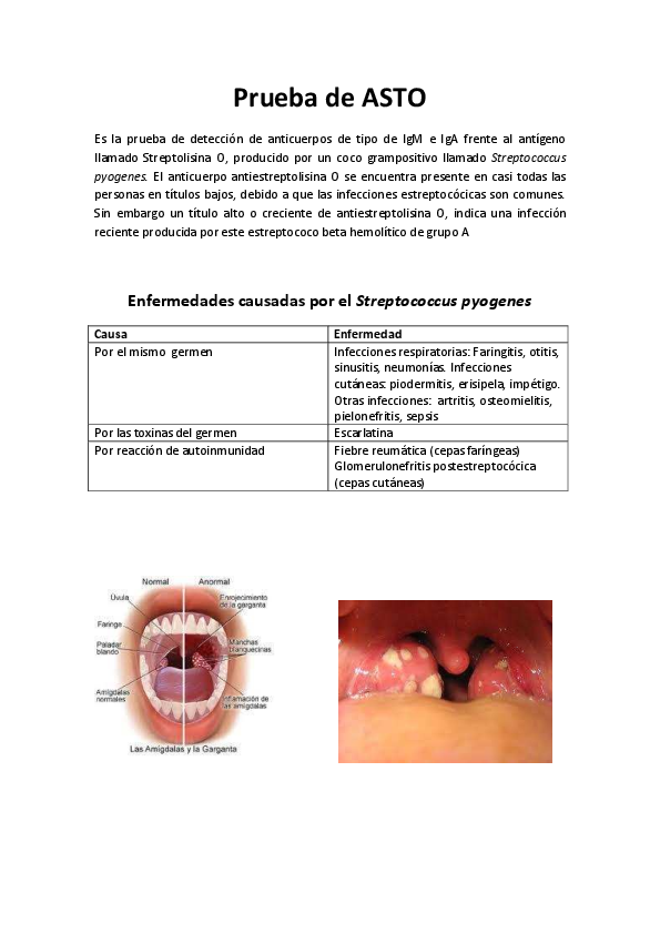 (PDF) Prueba de ASTO