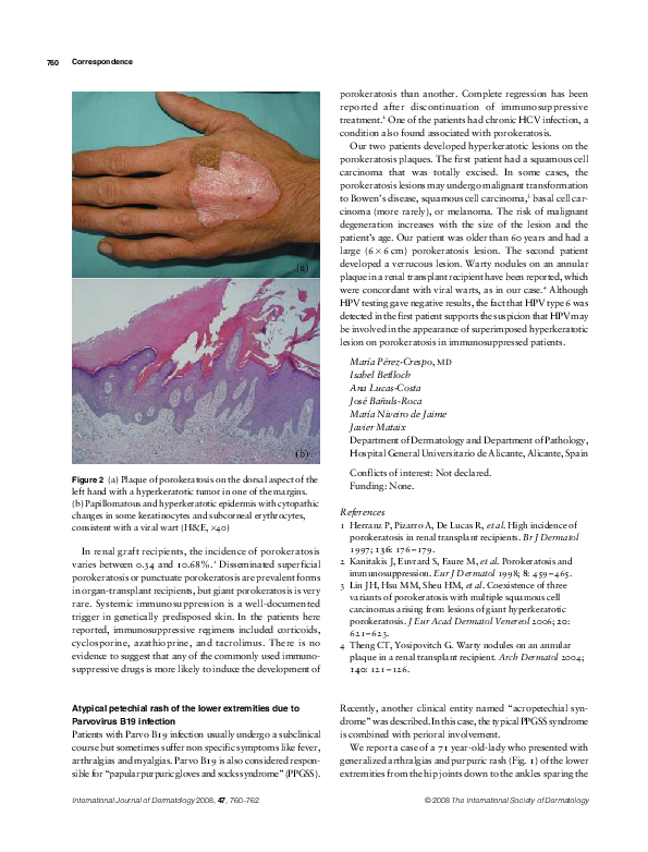 (PDF) Atypical petechial rash of the lower extremities due to ...