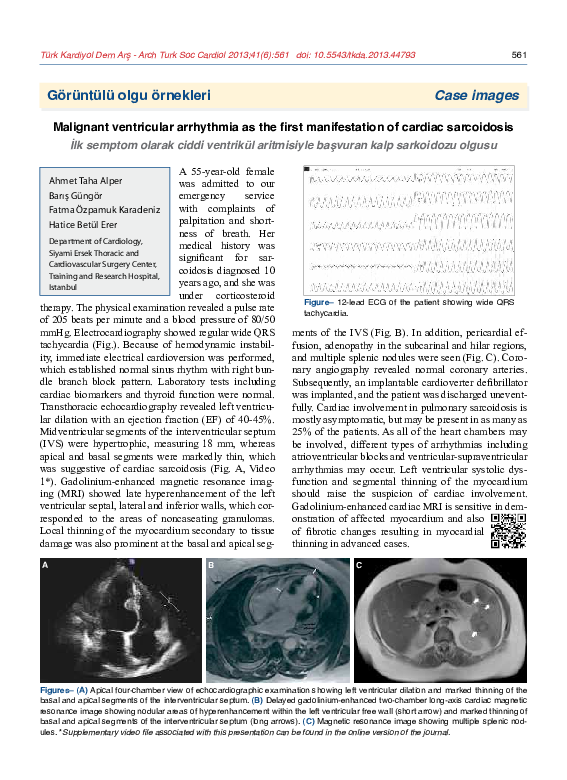 (PDF) Case images: Malignant ventricular arrhythmia as the first ...
