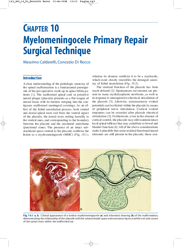 (PDF) Myelomeningocele Primary Repair Surgical Technique