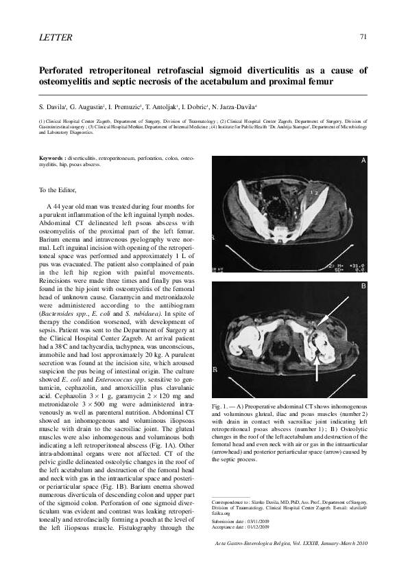 (PDF) Perforated retroperitoneal retrofascial sigmoid diverticulitis as ...