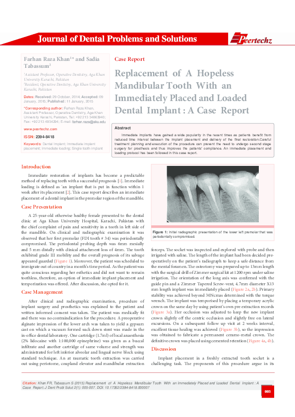 (PDF) Replacement of A Hopeless Mandibular Tooth With an Immediately ...