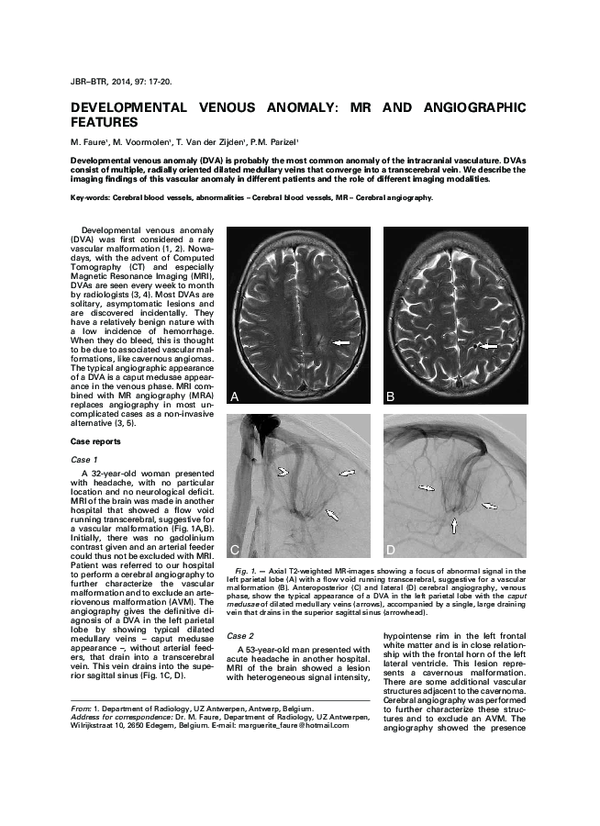 (PDF) Developmental venous anomaly: MR and angiographic features