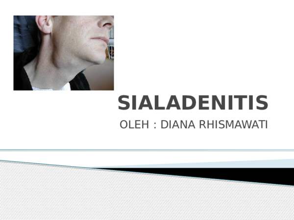 (PPT) SIALADENITIS