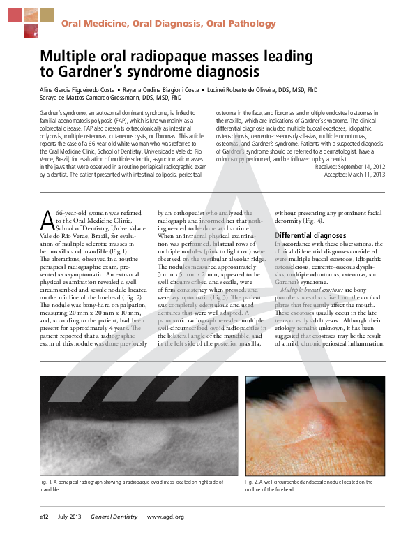 (PDF) Multiple oral radiopaque masses leading to Gardner's syndrome ...