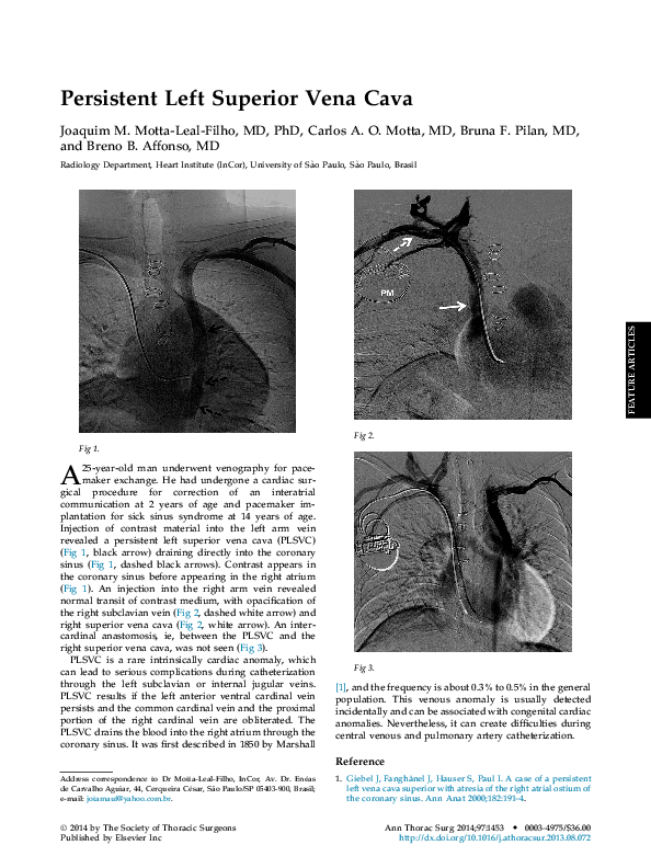 (PDF) PERSISTENT LEFT SUPERIOR VENA CAVA