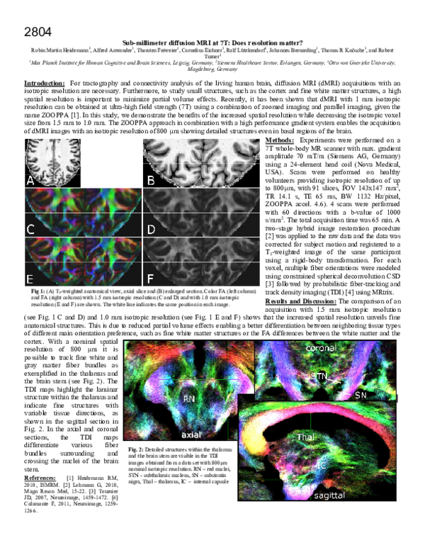 (PDF) 1877 Sub-Millimeter dMRI | Robin Heidemann and Ralf Lützkendorf ...
