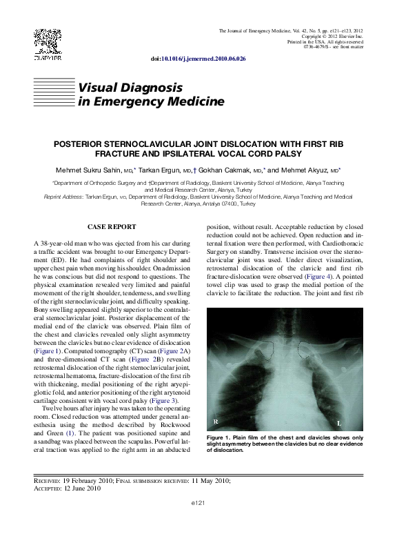 (PDF) Posterior Sternoclavicular Joint Dislocation with First Rib ...