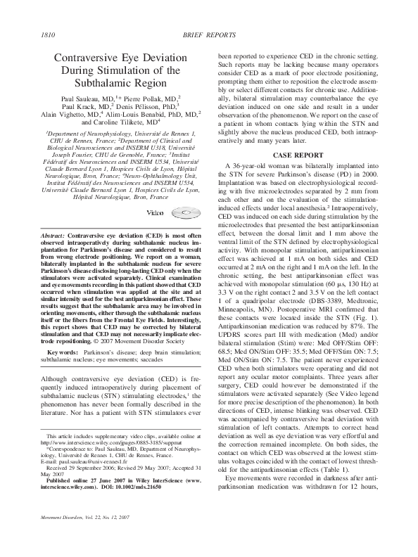 (PDF) Contraversive eye deviation during stimulation of the subthalamic ...