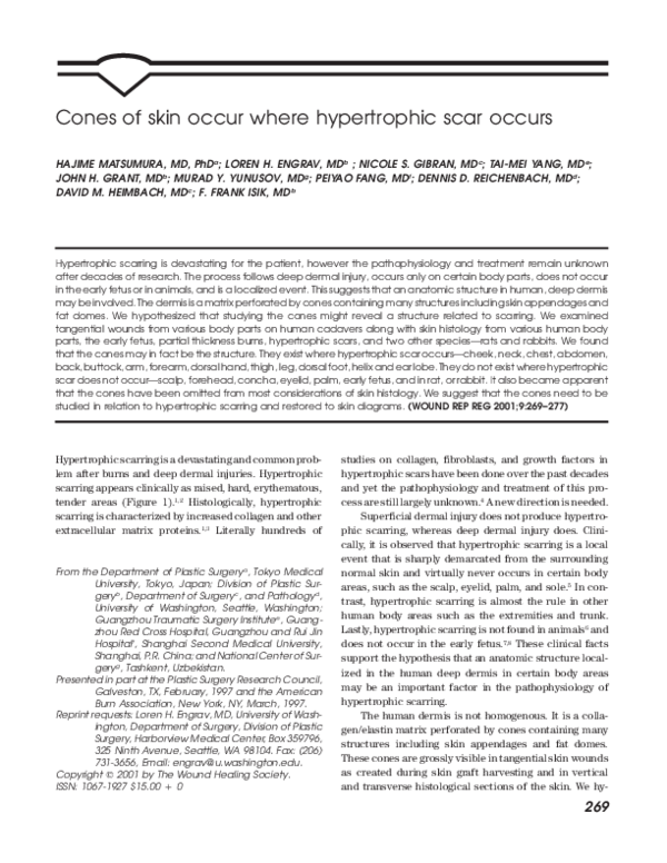 (PDF) Cones of skin occur where hypertrophic scar occurs