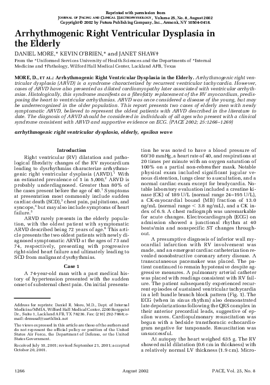 (PDF) Ventricular Tachycardia as a First Presentation of Arrhythmogenic ...