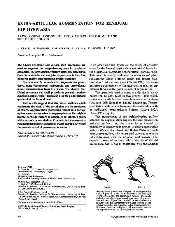 (PDF) Extra-articular augmentation for residual hip dysplasia ...