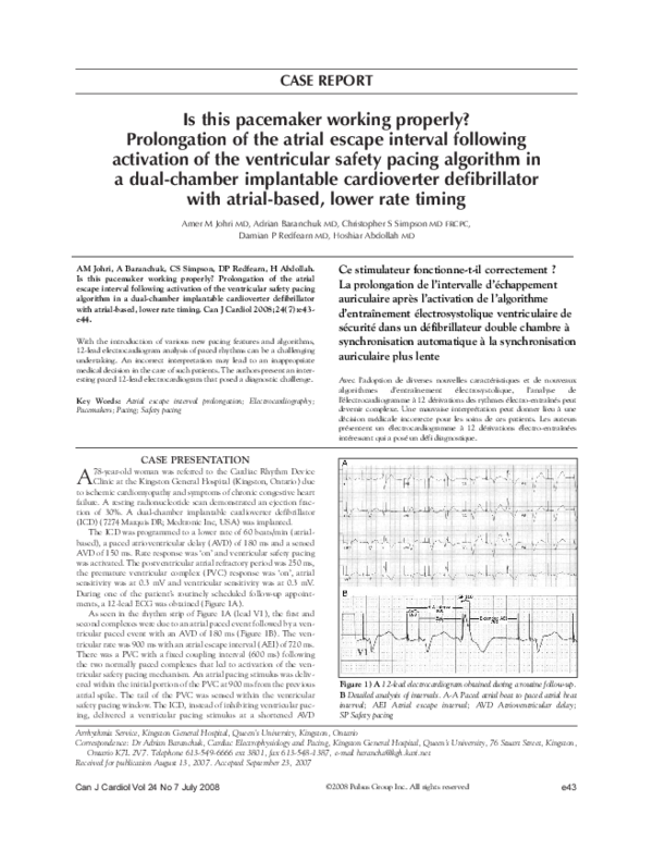 (PDF) Is this pacemaker working properly? Prolongation of the atrial ...